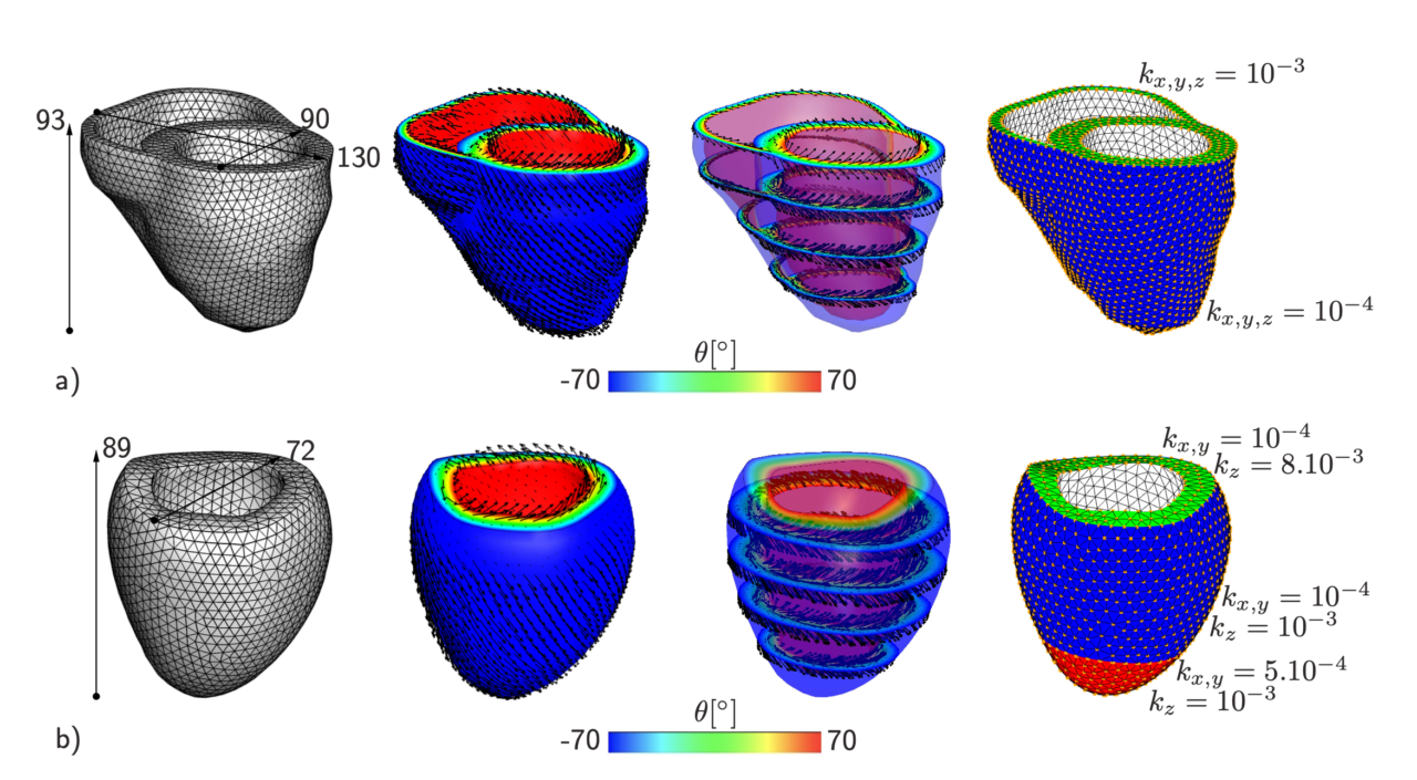 Coreform - Coreform Cubit enables patient-specific cardiac models to ...
